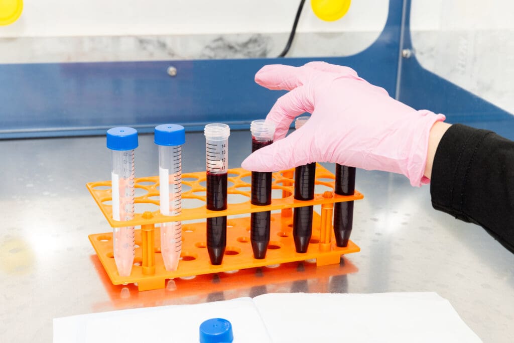 Natural Healing Through PRP: What You Need To Know - PUR-FORM